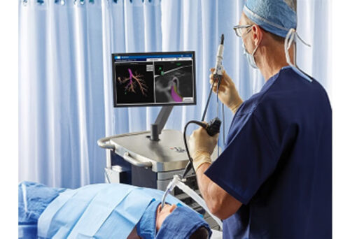 ILLUMISITE Fluoroscopic Navigation Platform | HAT Design Works